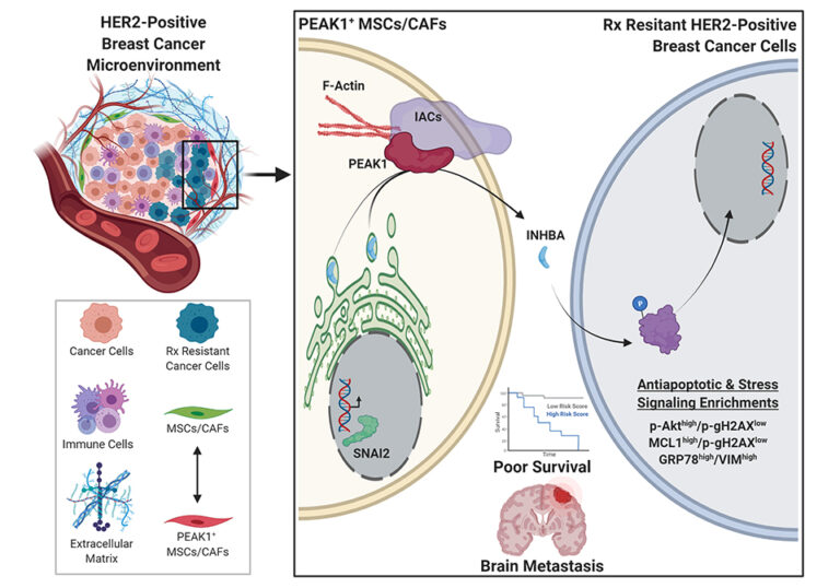 Tumor Extracellular Matrix Reduces Therapeutic Efficiency in Solid ...
